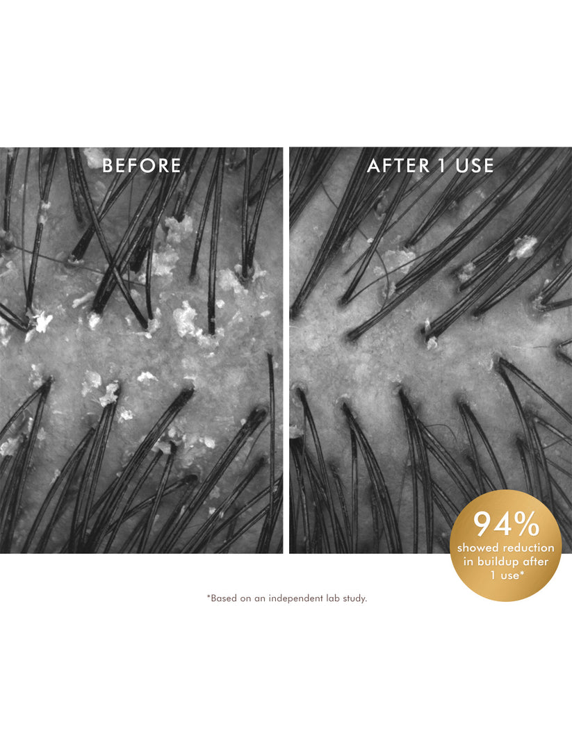 Purifying Pre-Wash Scalp Scrub for All Hair Types | Moroccanoil®