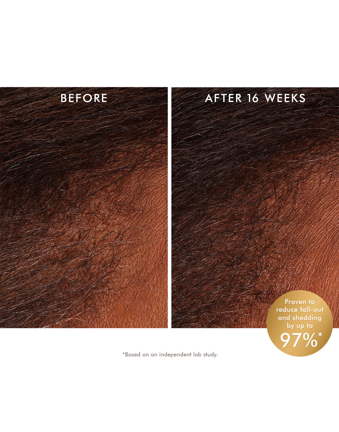 Revitalizing Scalp Tonic for Thinning Hair | Moroccanoil®